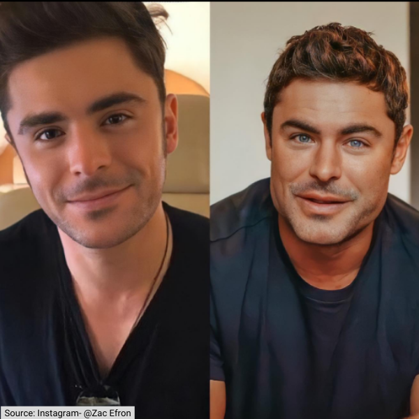 Zac Efron's Explains How His Facial Features Changed | Al Bawaba
