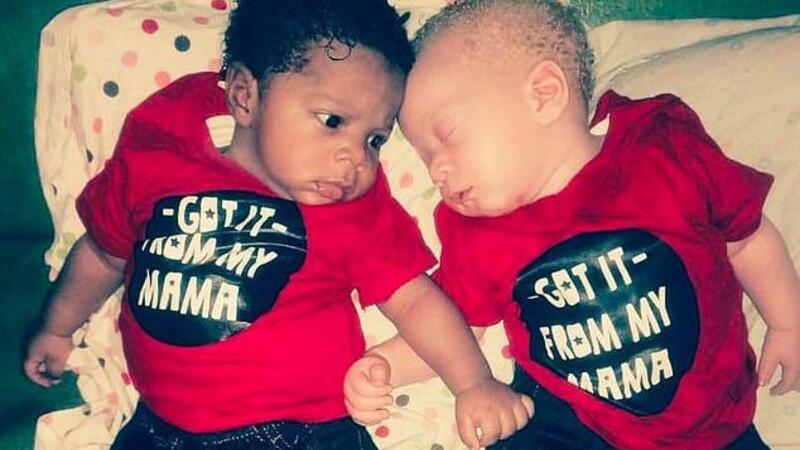 Mom Gives Birth to Twins Each With Different Skin Color | Al Bawaba