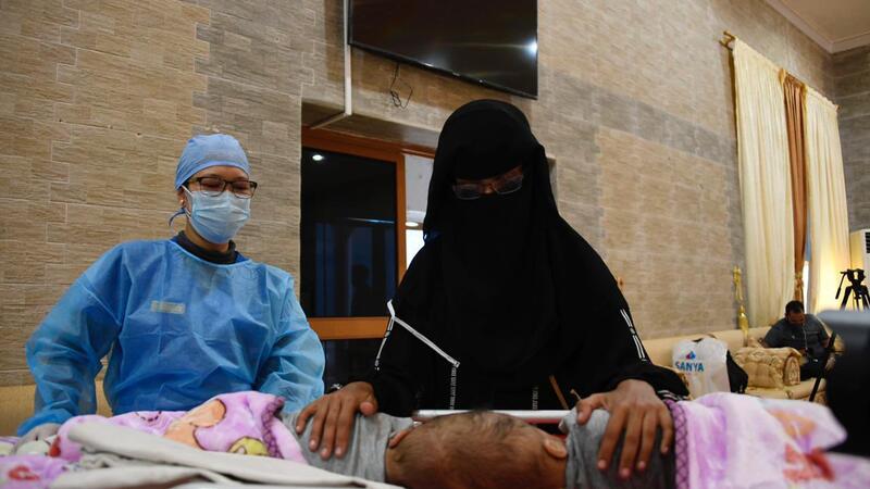 Yemeni Conjoined Twins 'Yousuf and Yassin' Arrive in Saudi | Al Bawaba