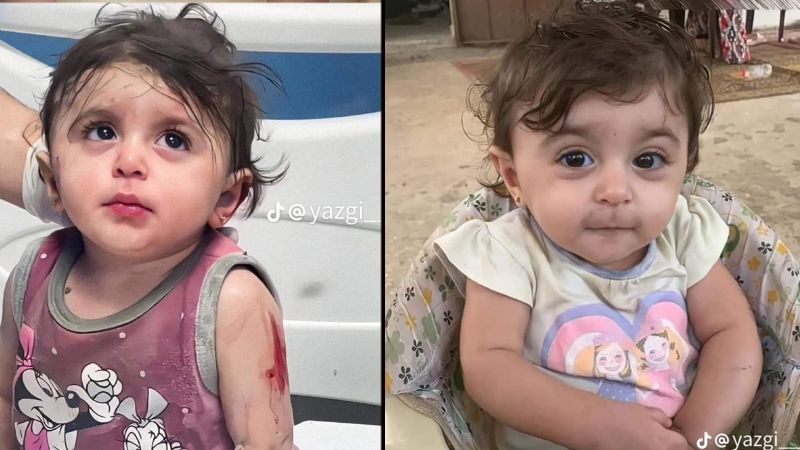 Palestinian baby Sham feels better after injury: (Photo) | Al Bawaba