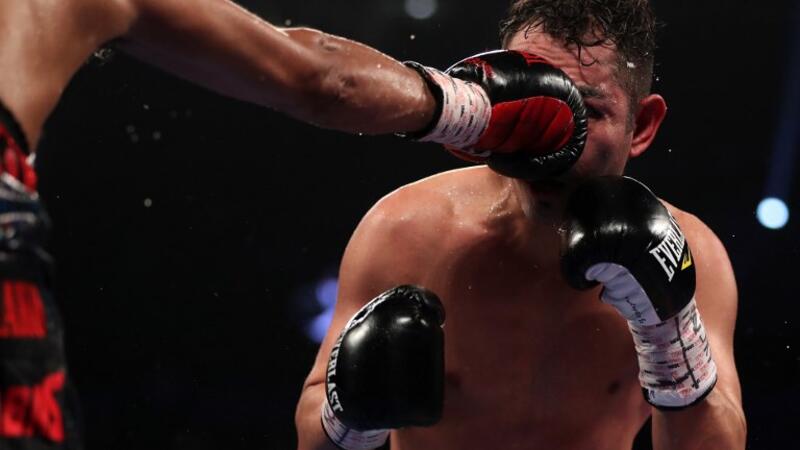 Boxers, MMA fighters may face long-term harm to brain: study | Al Bawaba