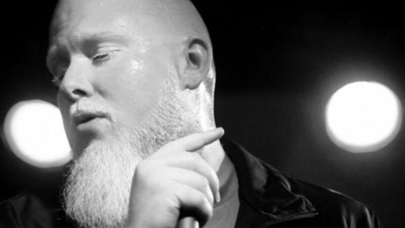 Hip-Hop artist "Brother Ali" talks class and racial privileges through ...