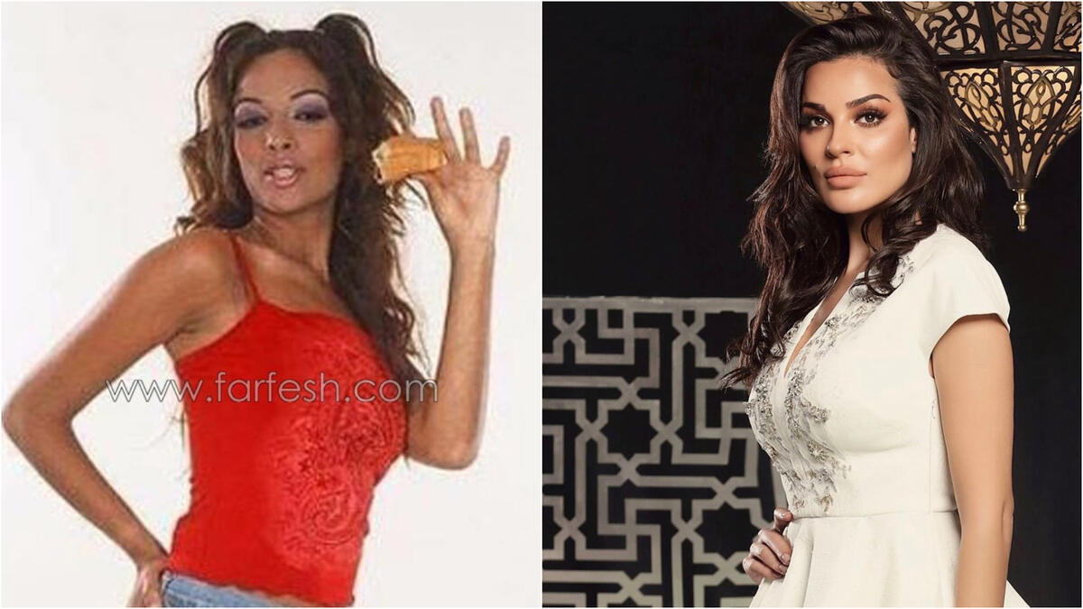 Shocking Before and After Shots for Arab Celebrities Underwent Jaw ...