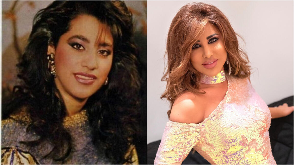 Shocking Before and After Shots for Arab Celebrities Underwent Jaw ...