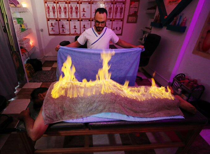 Egyptian Man Uses Fire as Massage to Relieve Pain | Al Bawaba
