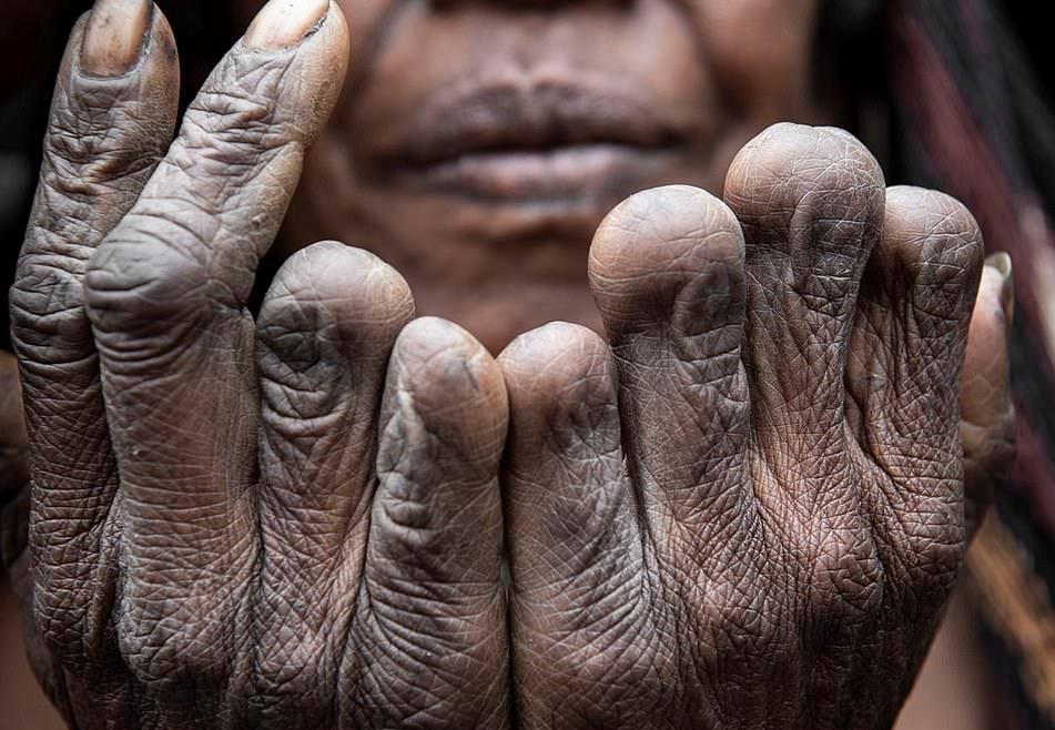 Mummified Bodies and Chopping Off Fingers: Meet The Dani Tribe of ...