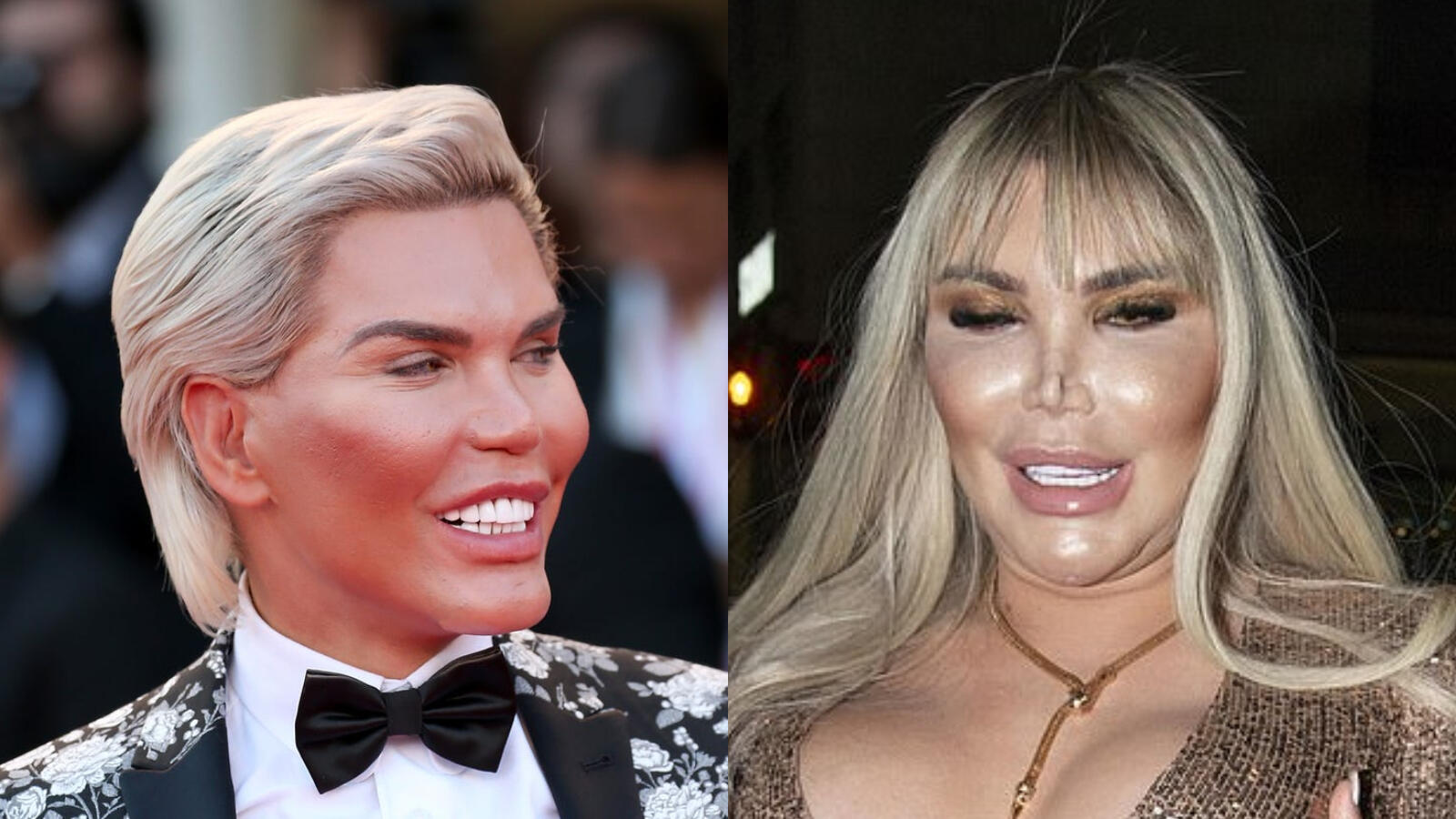 Roddy Alves Showcases Her Ample Assets in Milan... After Expressing ...