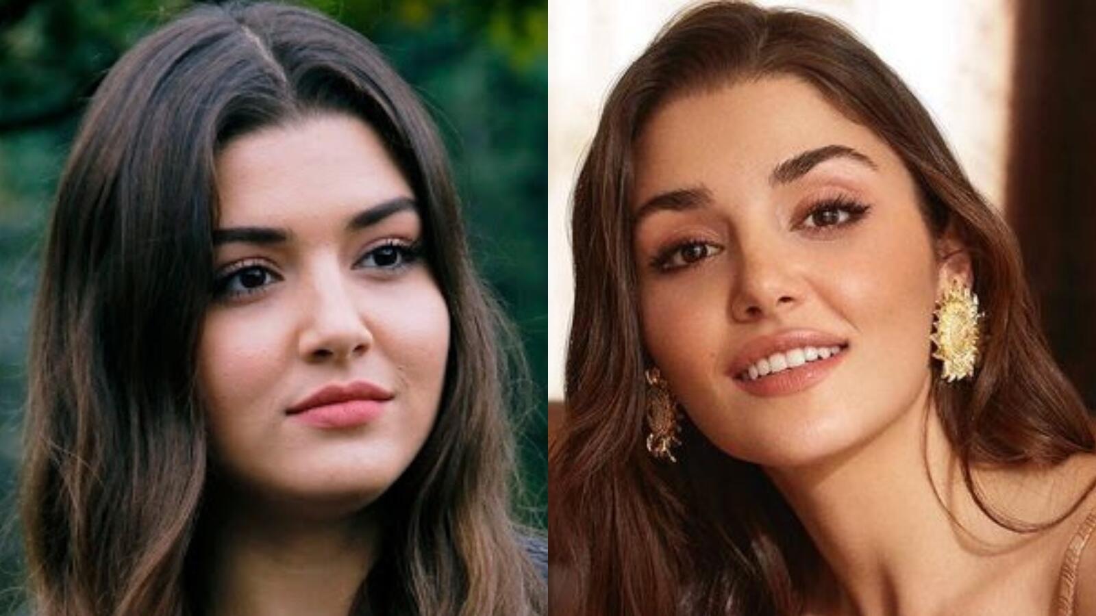 Hande Erçel's Plastic Surgeries Put Her in Trouble After Being Named ...