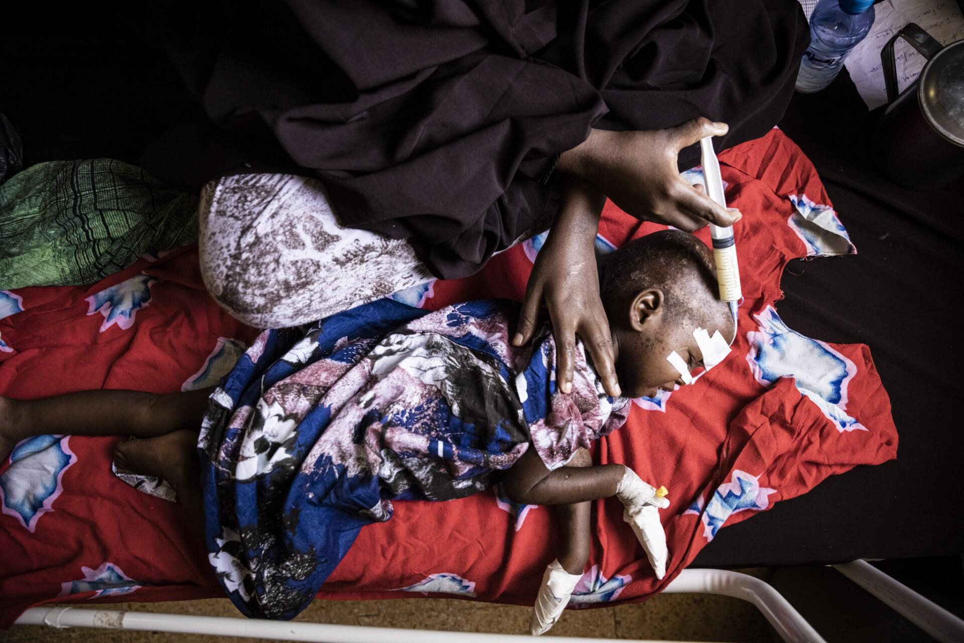 Will The UN Be Able to Prevent Famine, Tackle Drought in Somalia? | Al ...