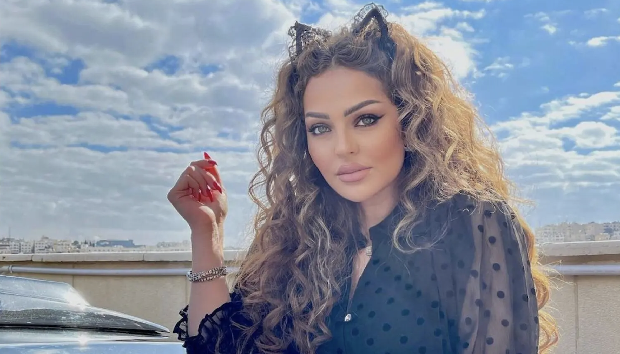 Zain Karazon undergoes gastric sleeve surgery | Al Bawaba