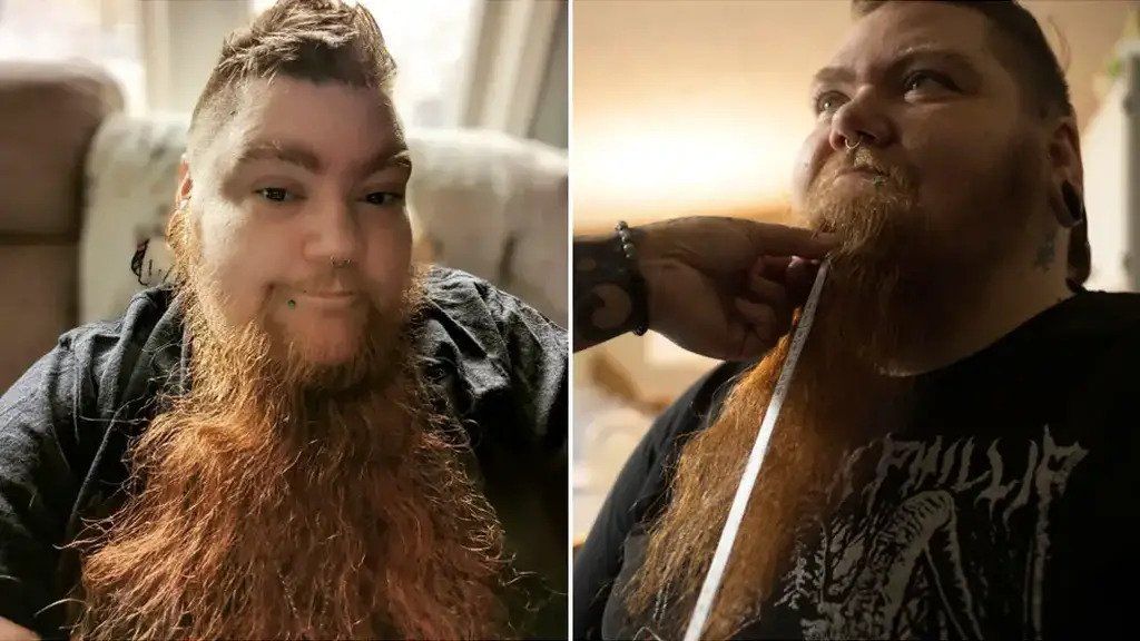 How long can woman's beard grow? American wins world record | Al Bawaba