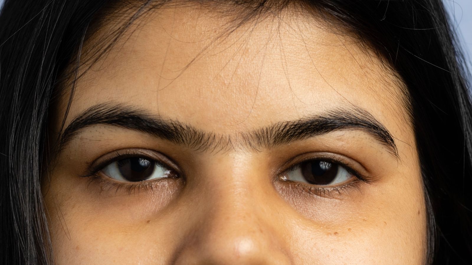 تفسير حلم وجود شعر بين الحاجبين | البوابة