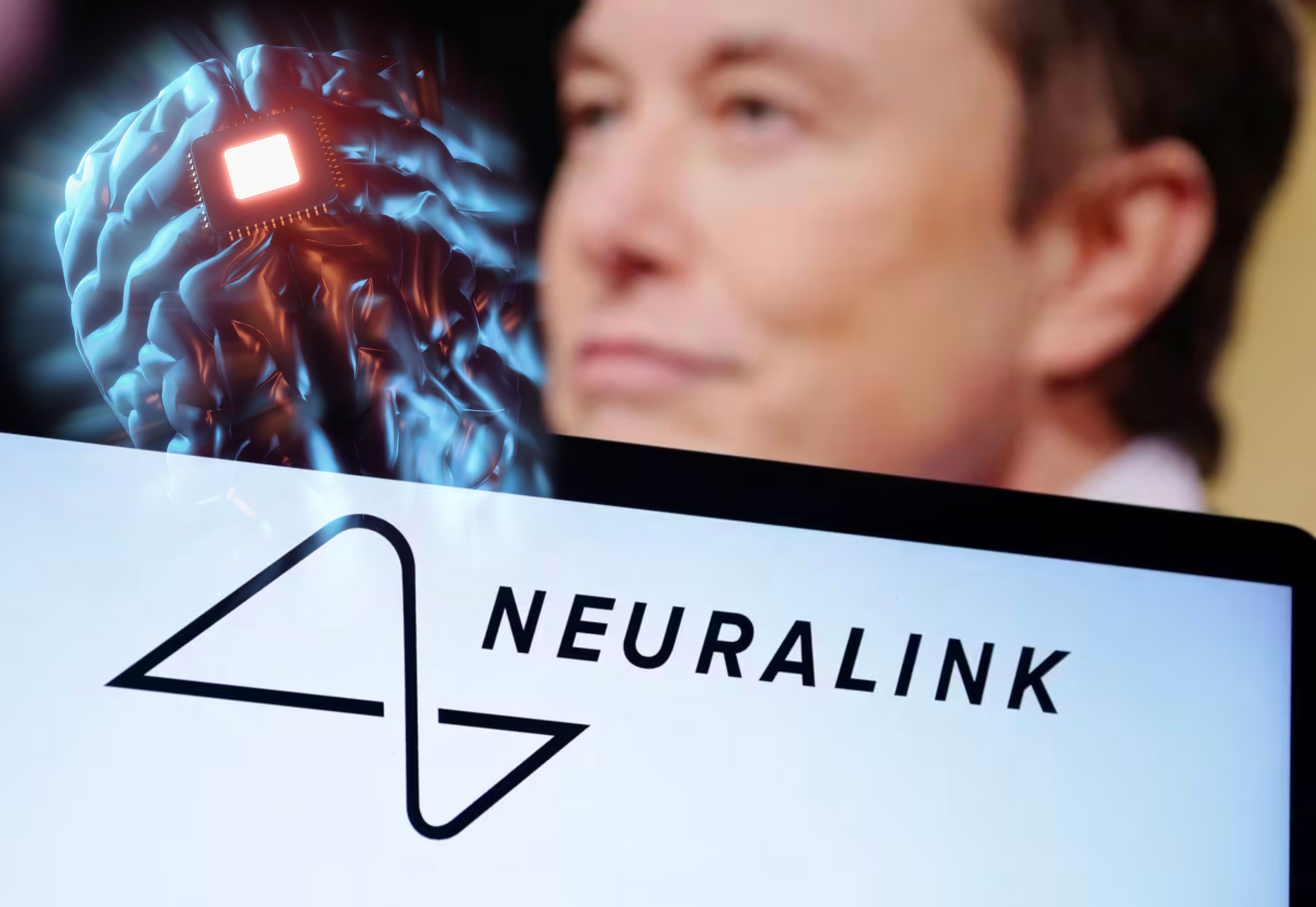 First human brain chip implanted by Elon Musk's Neuralink | Al Bawaba