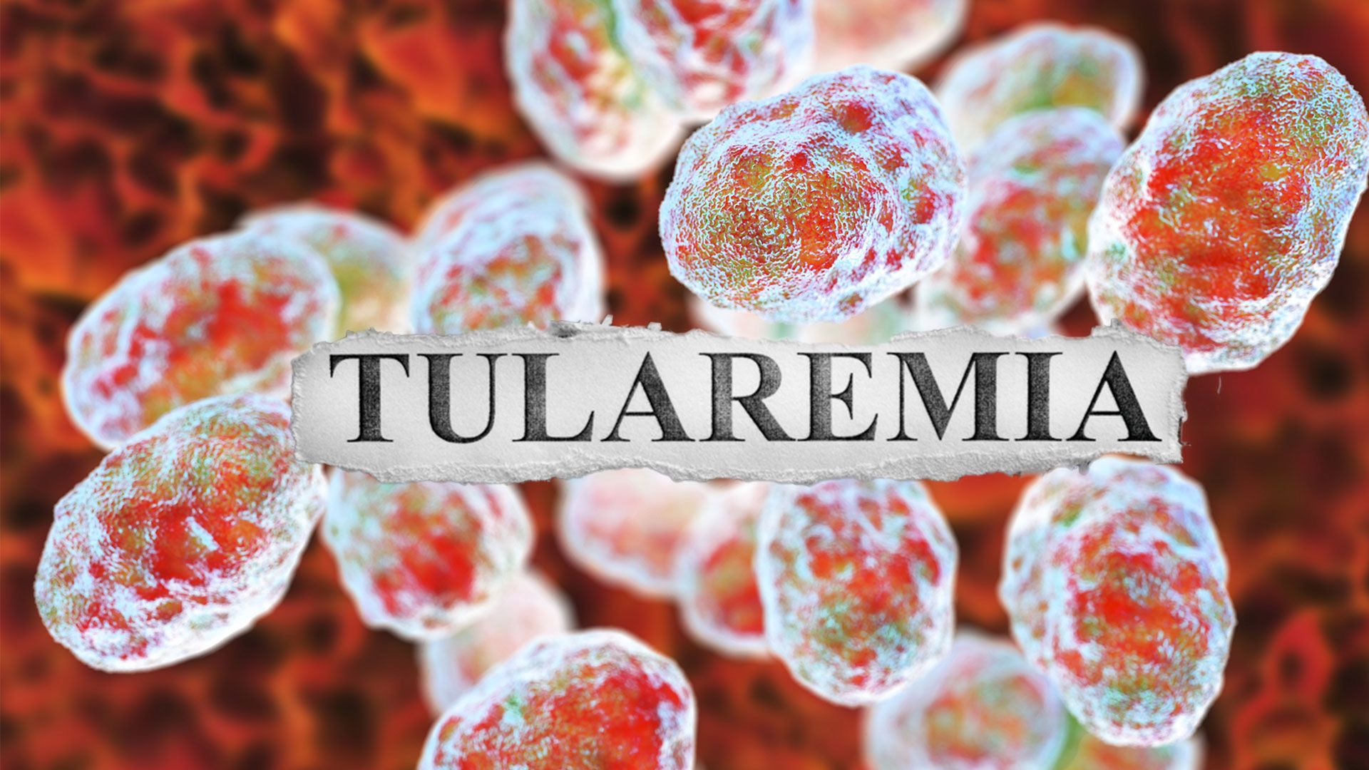 Deadly disease spreads in US, Here what we know about 'Tularemia' | Al ...