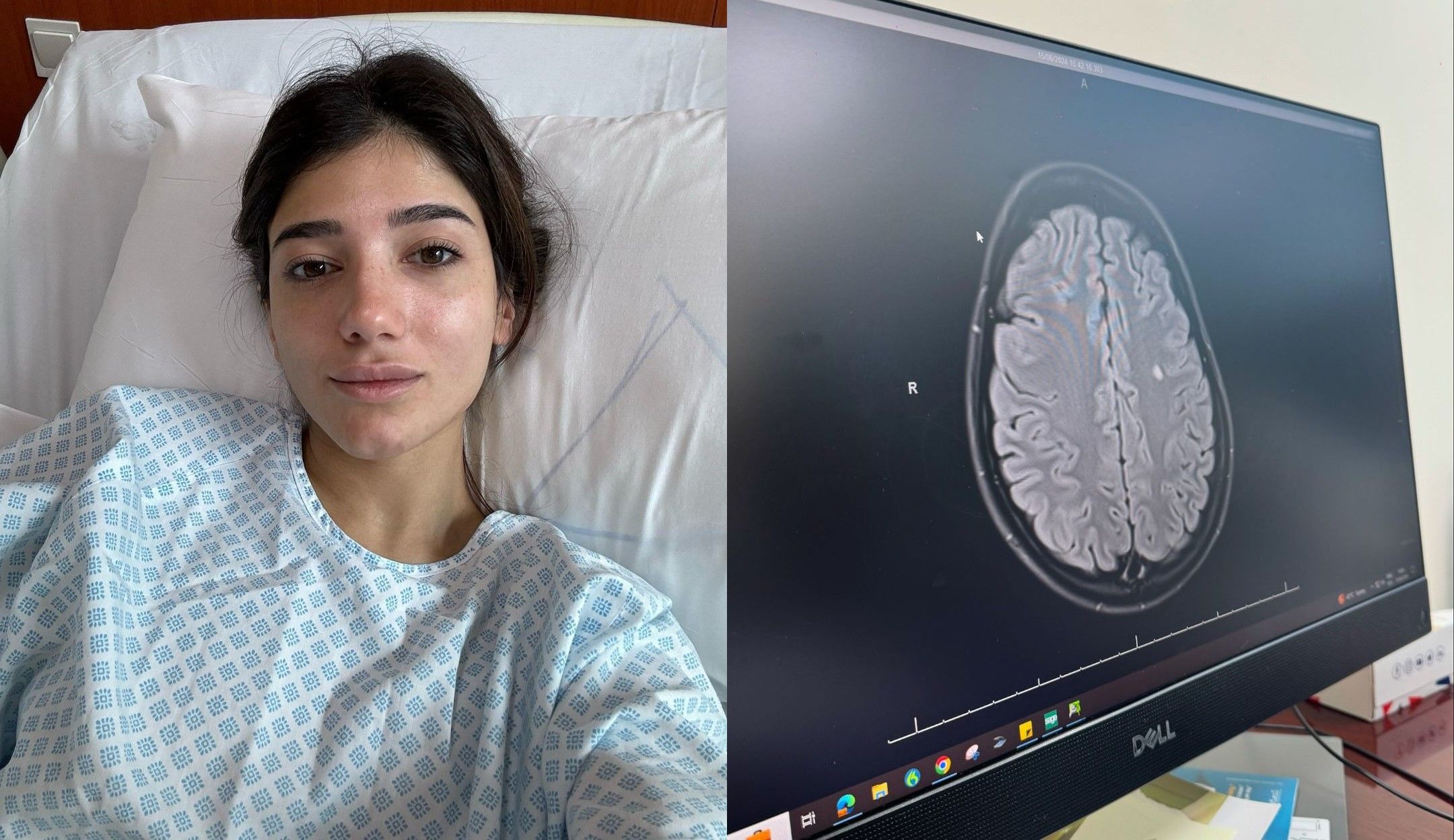 Narin Beauty opens up about brain disease and engagement to Rami Elias ...
