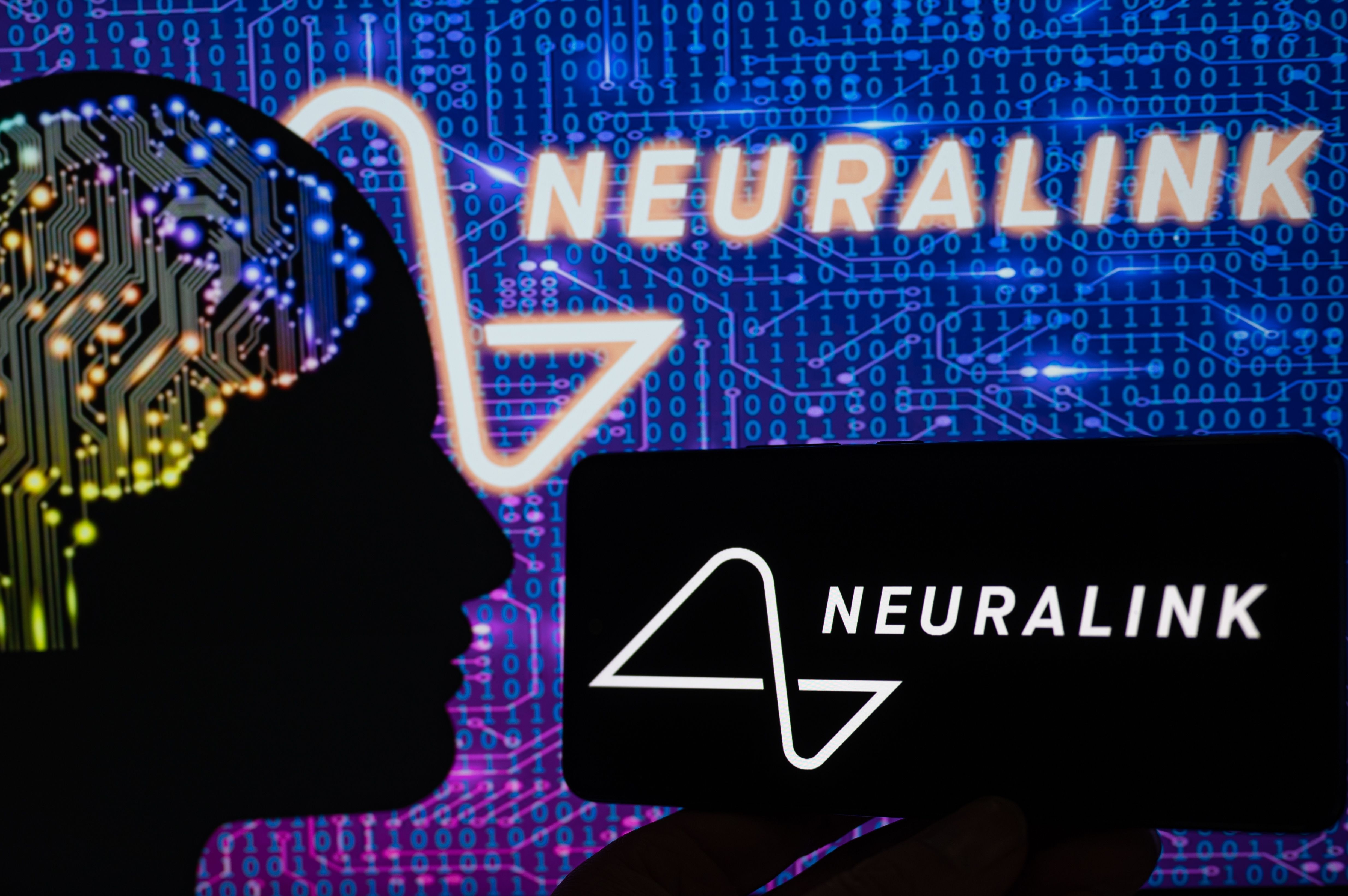 Neuralink implants chip into paralyzed patient’s brain | Al Bawaba