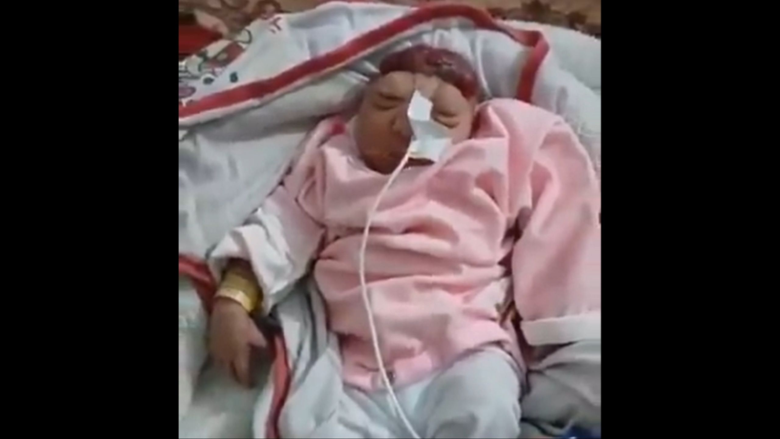 Video: Baby born without brain amid surge in birth defects in Gaza | Al ...