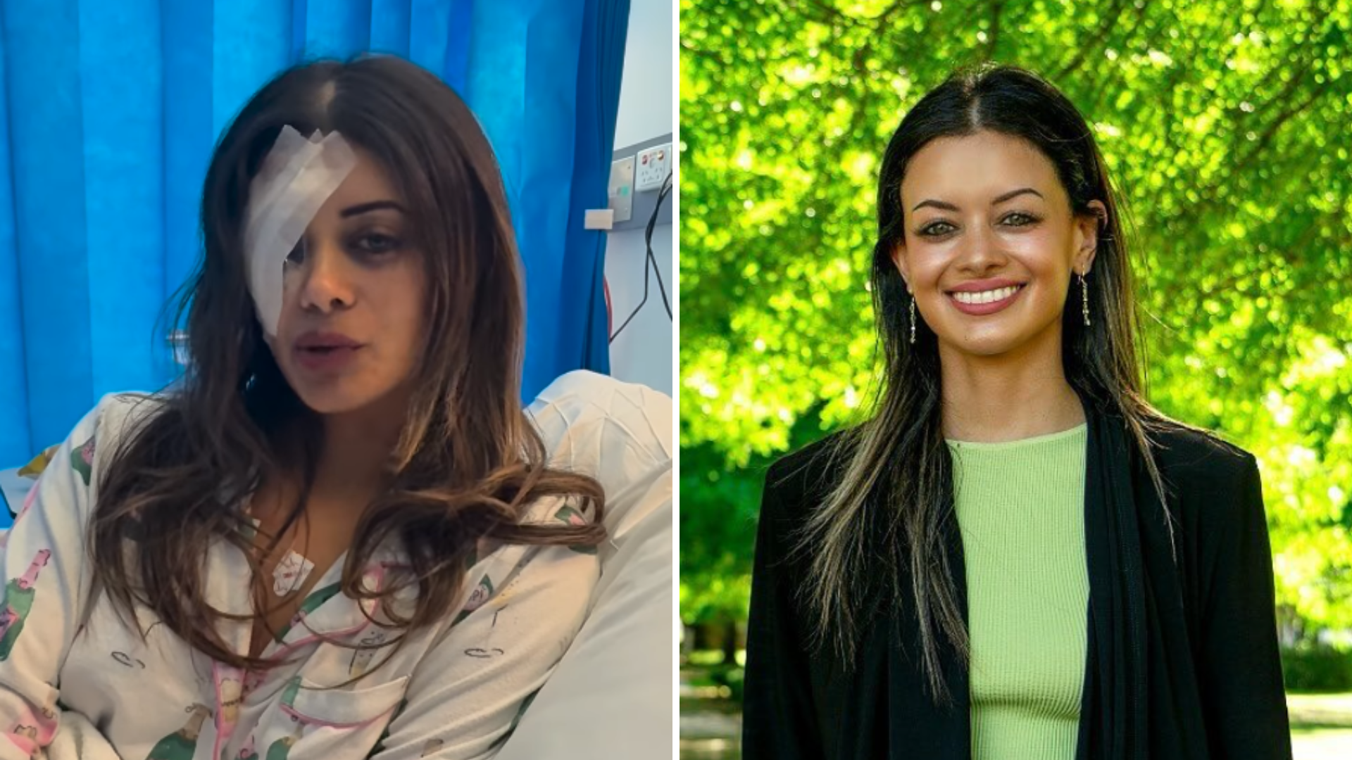 Hannah Thomas may lose eyesight amid police brutality at pro-Palestine ...