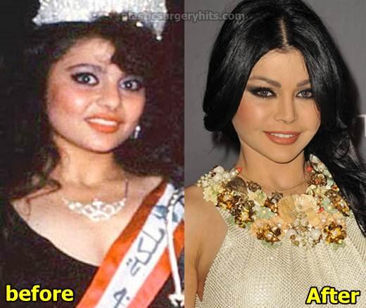 Haifa Wehbe ain't no natural beauty, according to her plastic surgeon ...