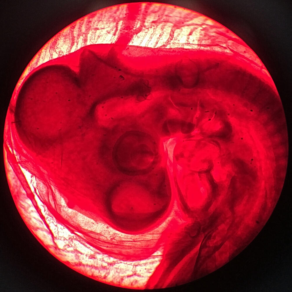 How to Save Babies from Brain-Damaging Birth Defects? | Al Bawaba